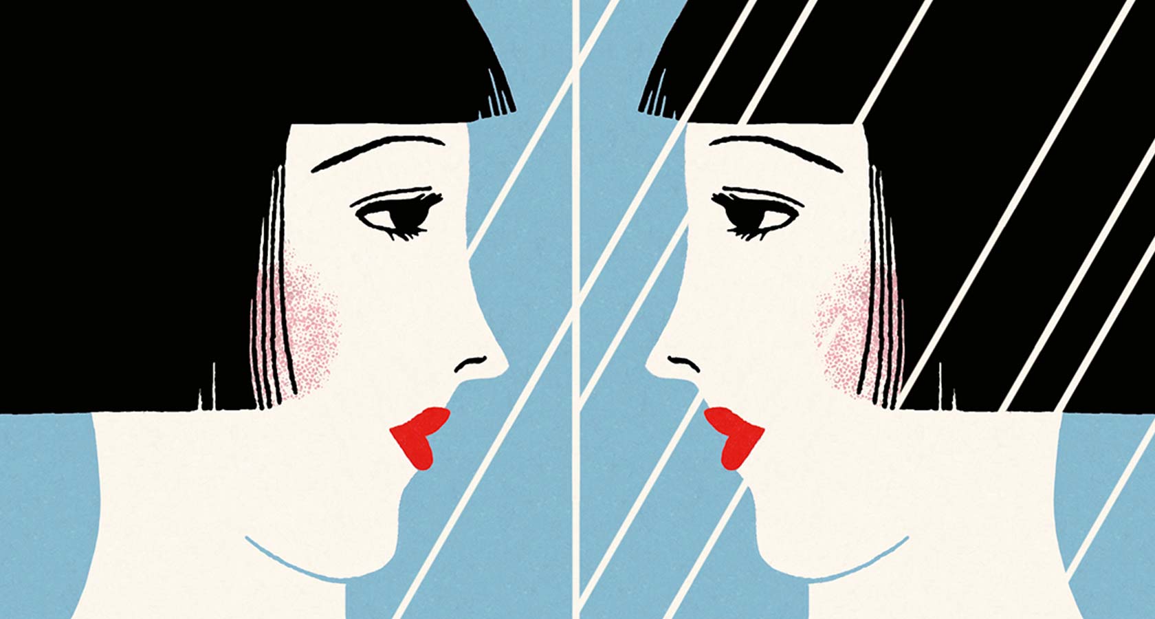 What causes female pattern hair loss and how can it be treated? - The D ...